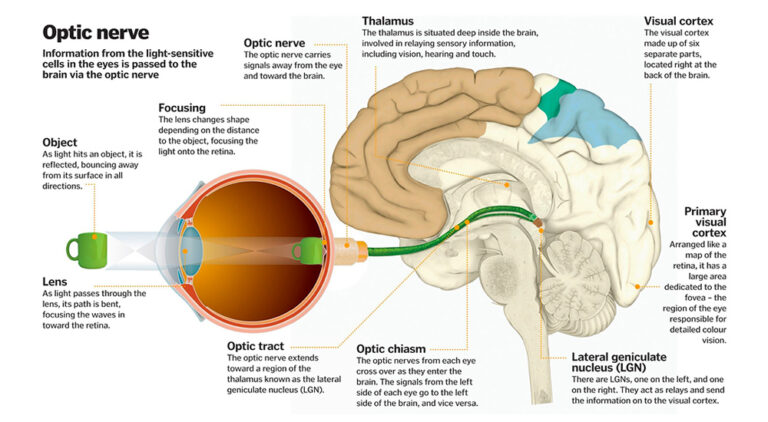 BRAINHACK ผ่าตัดระบบประสาท ส่งภาพจากกล้องยิงตรงสู่สมองคนตาบอดจาก ...